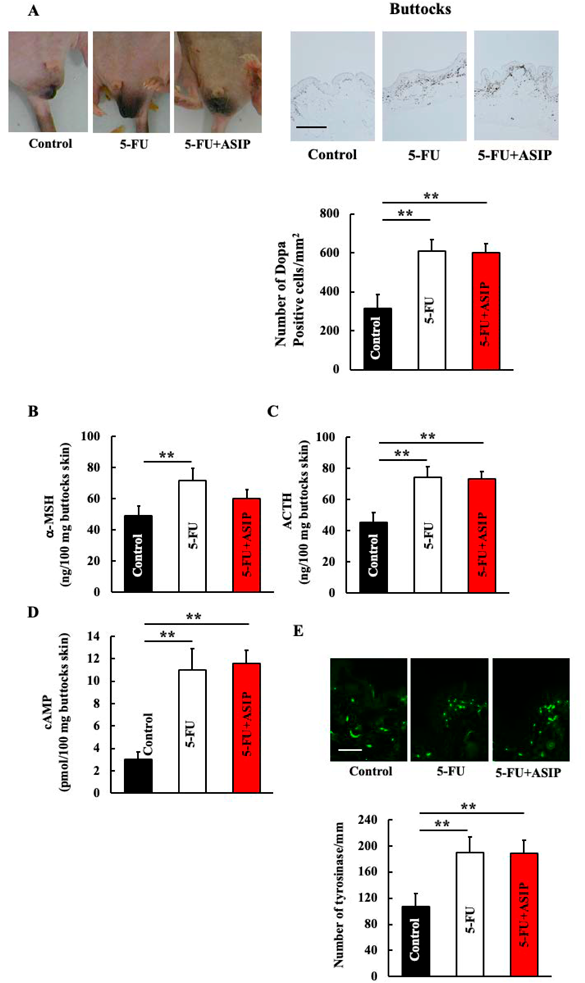 ACTH/cAMP-Mediated Skin Pigmentation Caused by 5-Fluorouracil ...